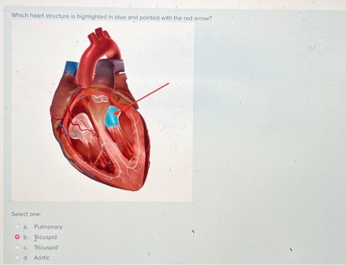 Solved Which heart structure is highlighted in blue and | Chegg.com