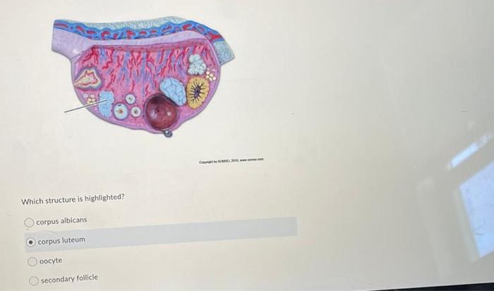 Solved Which structure is highlighted? corpus albicans | Chegg.com