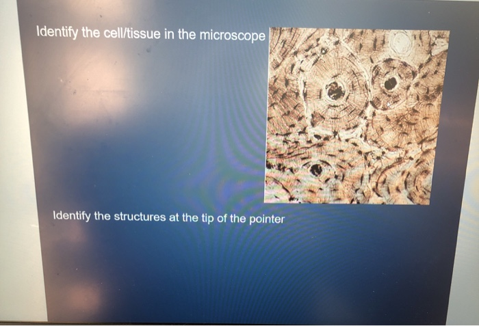 Solved Identify the cell/tissue in the microscope Identify | Chegg.com