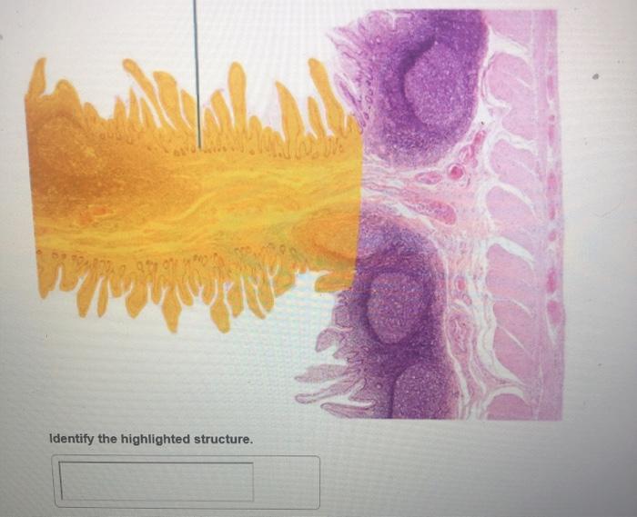 Solved Identify the highlighted structures. Which | Chegg.com Solved Identify the highlighted structures. Which | Chegg.com