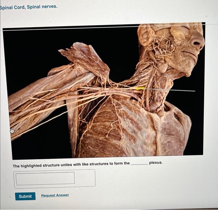 Solved Spinal Cord, Spinal nerves. The highlighted structure | Chegg.com