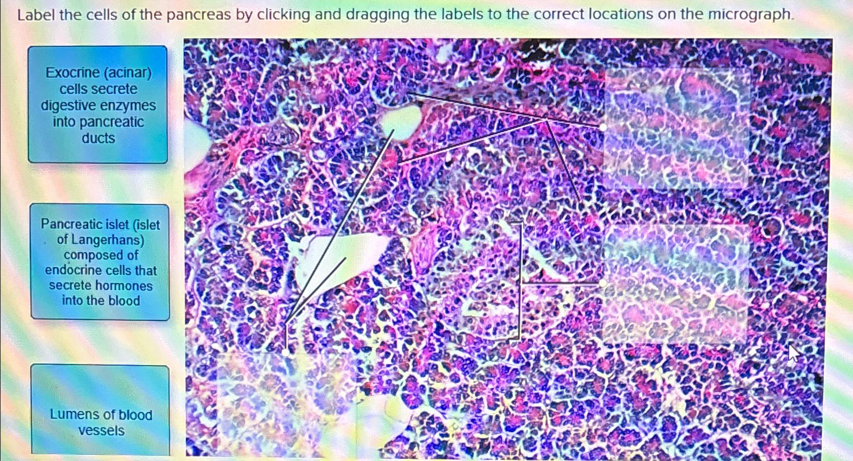 Solved Label the cells of the pancreas by clicking and | Chegg.com