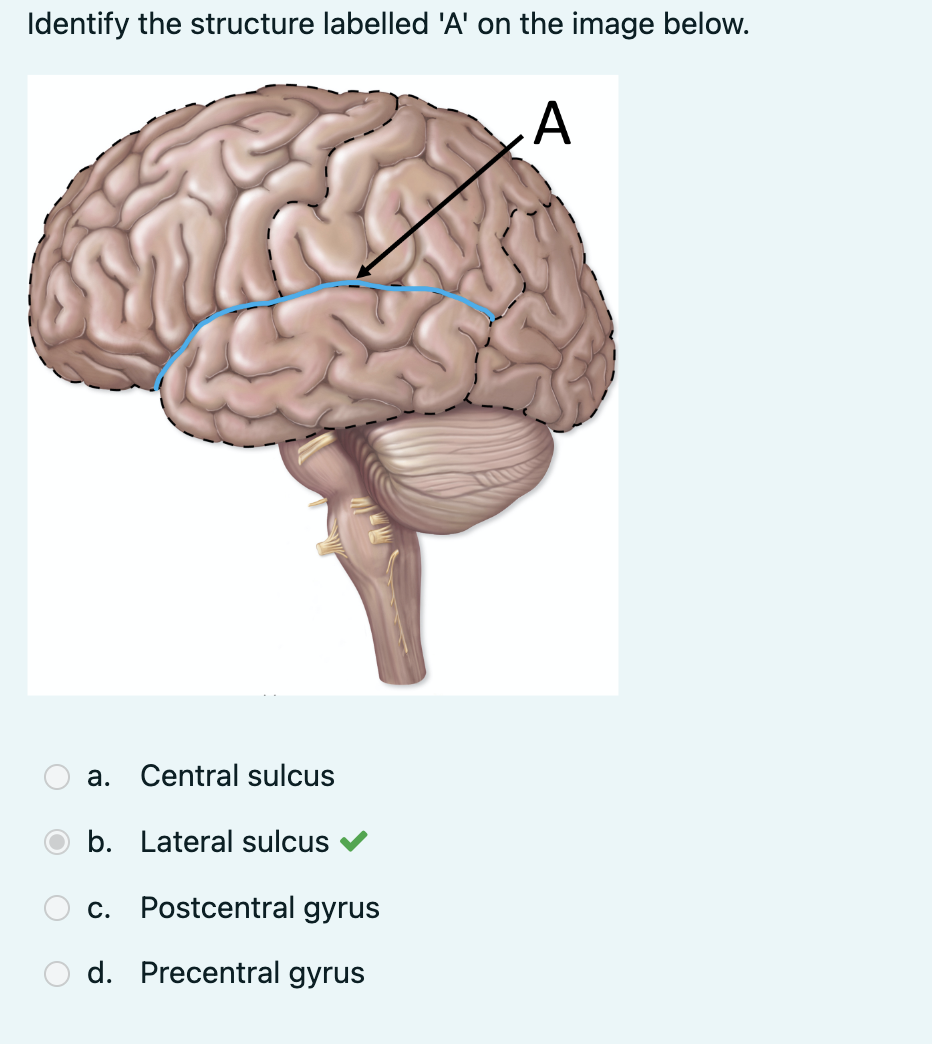 Solved Identify the structure labelled ' A ' ﻿on the image | Chegg.com