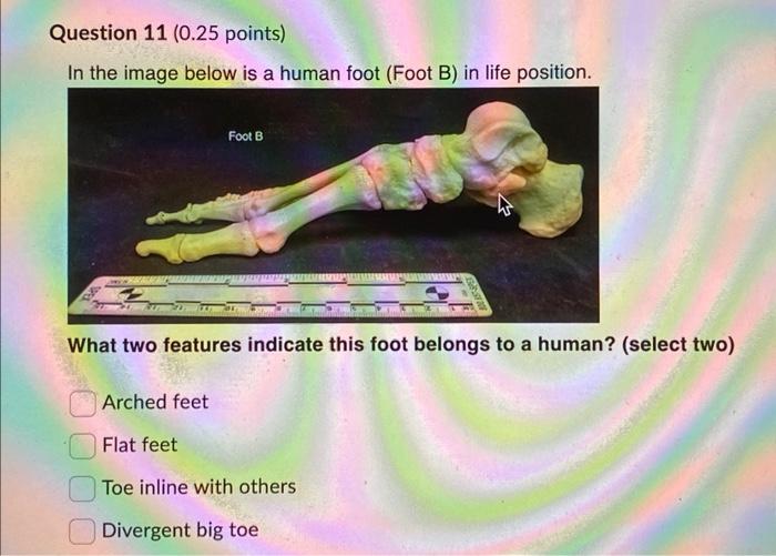 Below is an image of a hand. Does this hand belong to | Chegg.com
