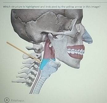 Solved Which structure is highlighted and indicated by the | Chegg.com