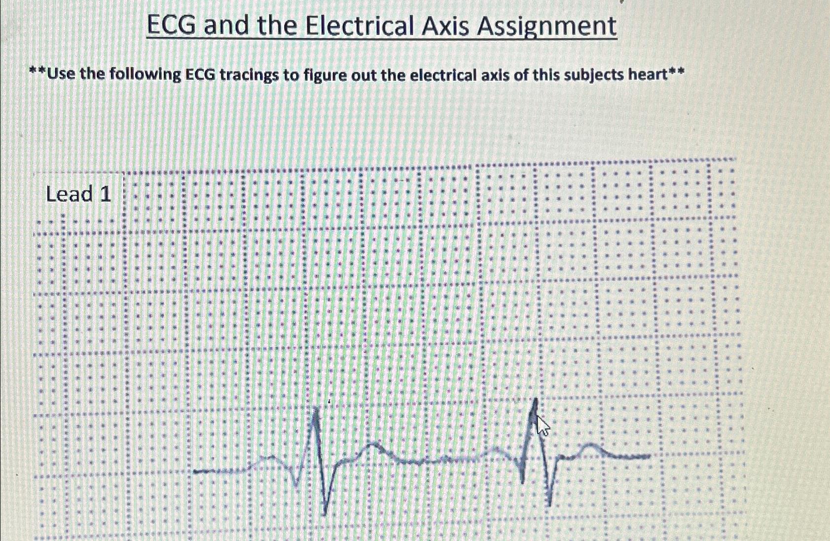 Solved ECG and the Electrical Axis Assignment** ﻿Use the | Chegg.com