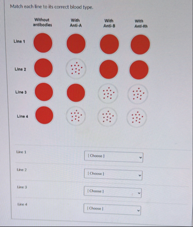 Match each line to its correct blood type. | Chegg.com