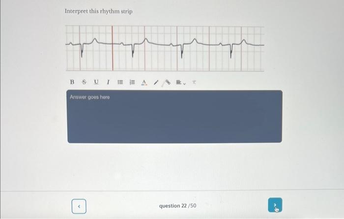 Solved Interpret this rhythm strip Interpret this rhythm | Chegg.com