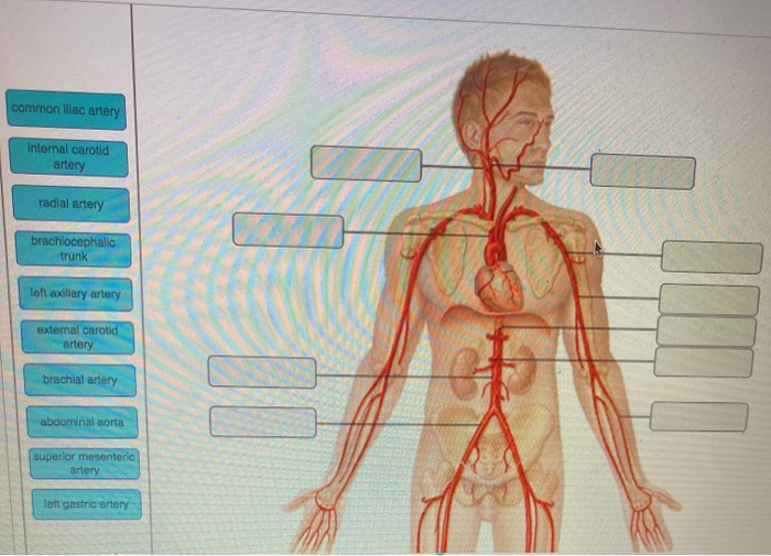 Solved common illac artery internal carotid artery radial | Chegg.com