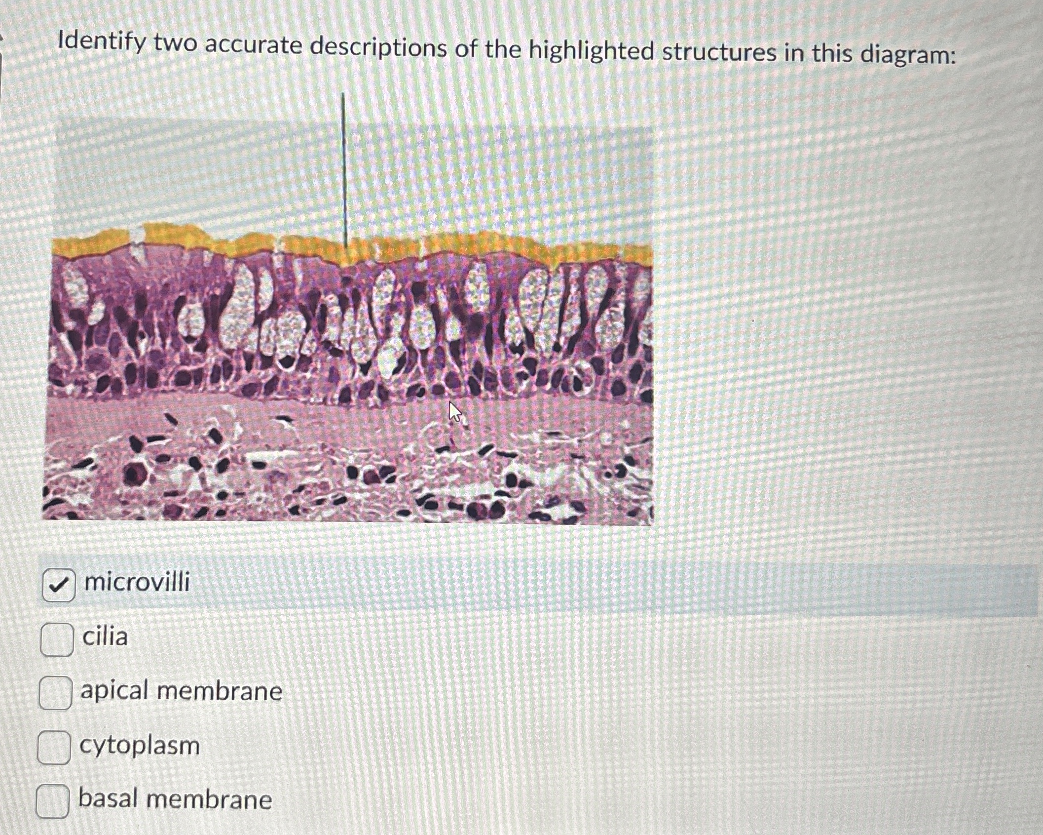 Solved Identify two accurate descriptions of the highlighted | Chegg.com