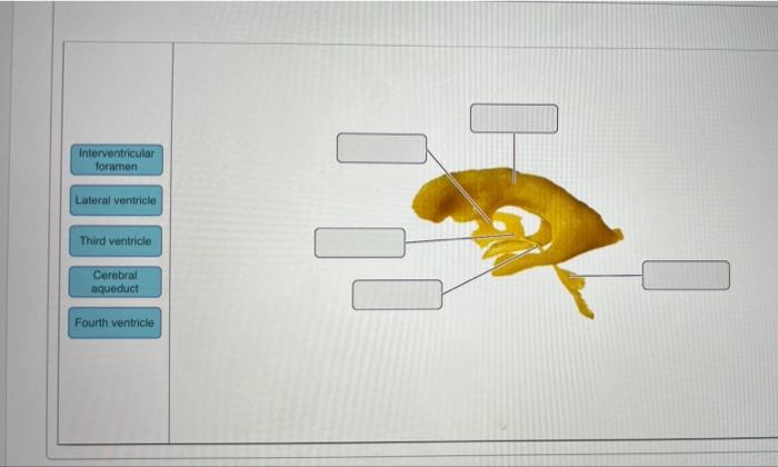 Solved Interventricular foramen Lateral ventricle Third | Chegg.com