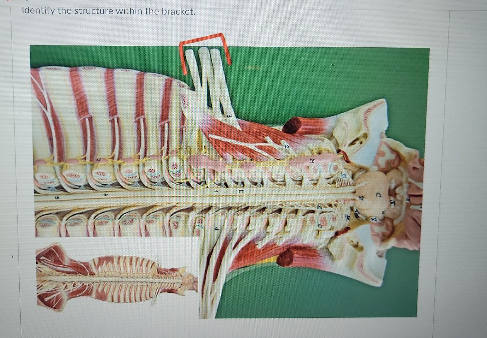 Solved Identify the structure at the tip of the | Chegg.com