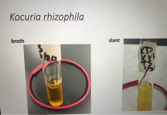 Results Tubes were inoculated and incubated at 37 | Chegg.com