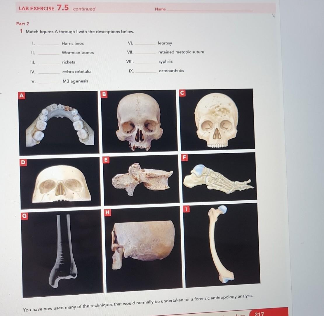 Solved Part 2 1 Match figures A through I with the | Chegg.com