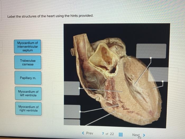 Solved Saved Saved Review #3: Heart and Blood Vessels Label | Chegg.com