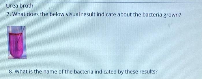 Solved Urea broth 7. What does the below visual result | Chegg.com