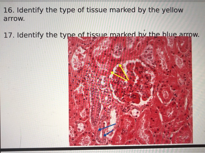 Solved 1. Identify the type of tissue marked by the yellow | Chegg.com