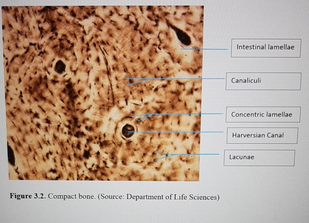 Solved only annotate Canaliculi, concentric lamellae and | Chegg.com