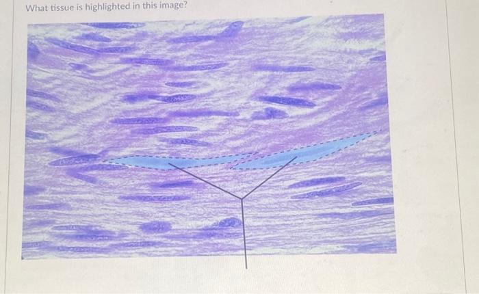 Solved What tissue is highlighted in this image? | Chegg.com