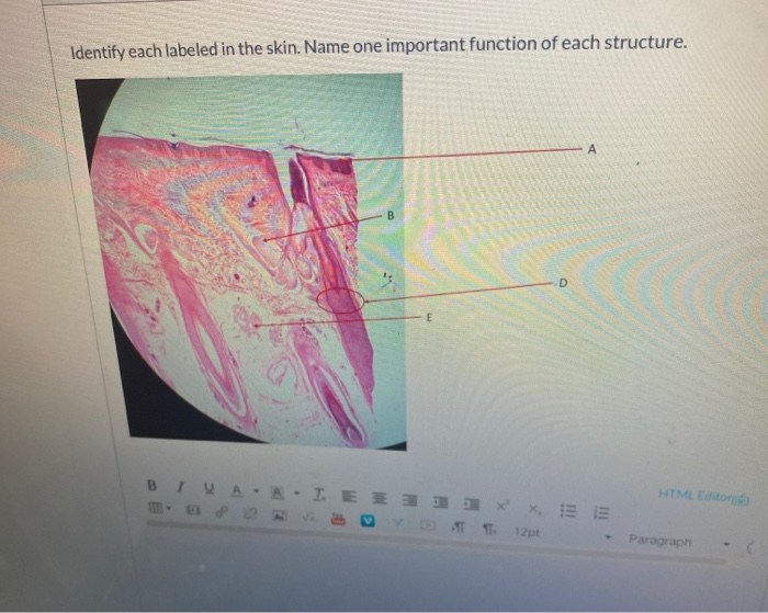 Solved Identify each labeled in the skin. Name one important | Chegg.com