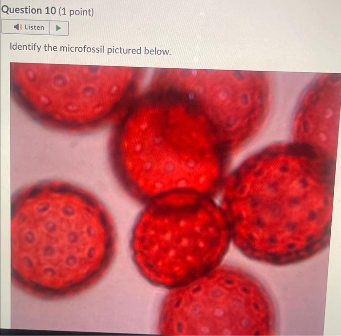 Solved Identify the microfossil pictured | Chegg.com