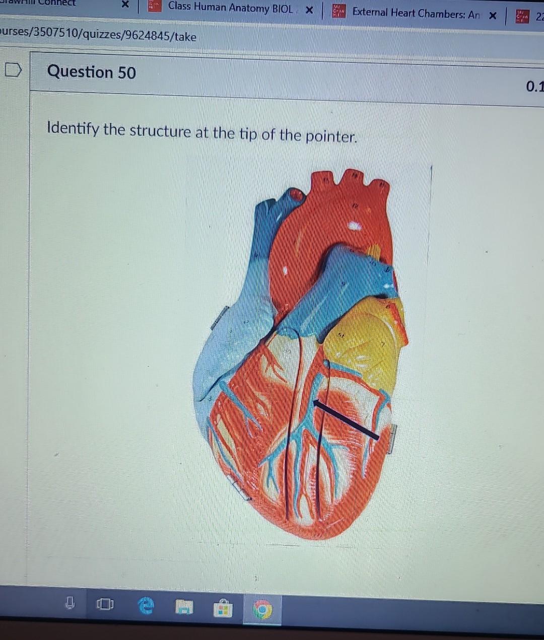 Solved Identify the part of the conducting system at the tip | Chegg.com