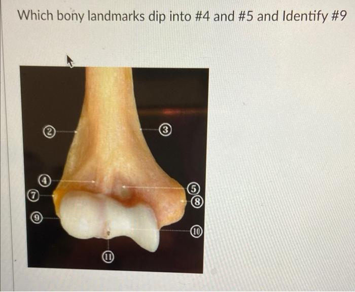 Solved Identify the following bony landmarks #6 - #8 - # 10 | Chegg.com