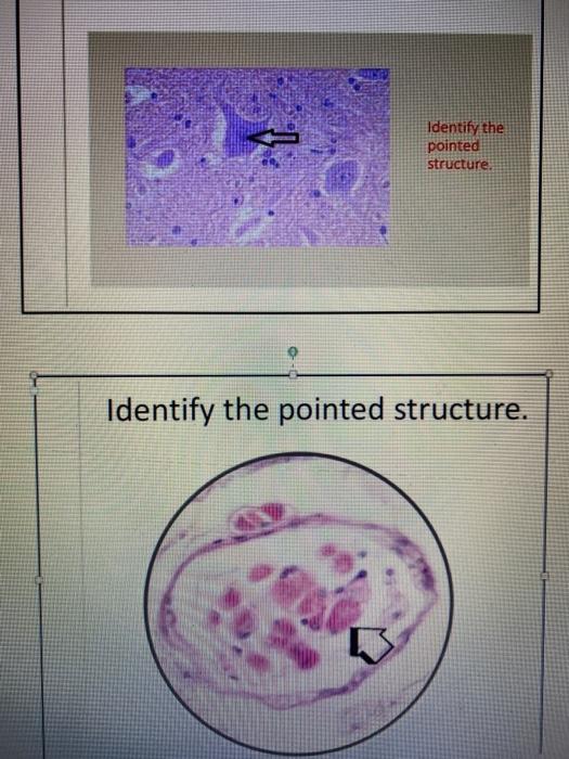 Solved Identify the pointed structure. Identify the pointed | Chegg.com Solved Identify the pointed structure. Identify the pointed | Chegg.com