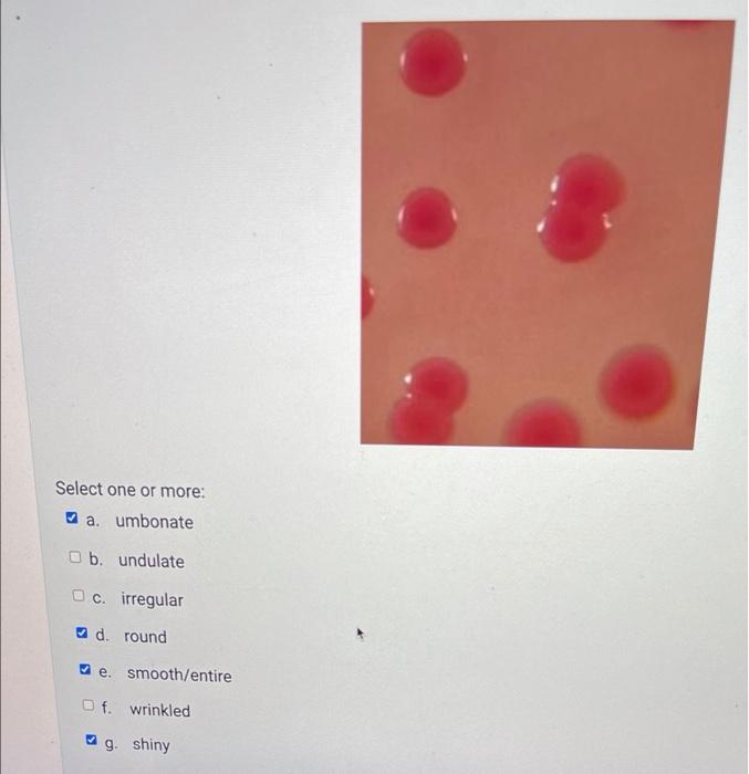 Solved Select one or more: a. umbonate b. undulate O c. | Chegg.com