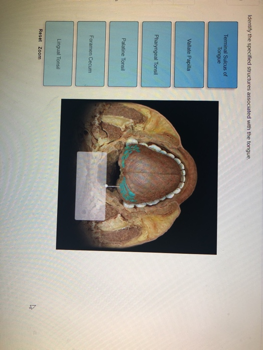 Solved Identify the specified structures associated with the | Chegg.com