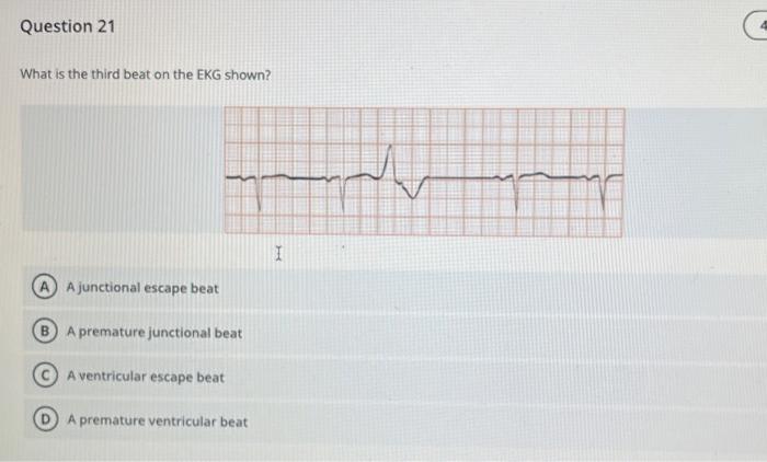 Solved Question 21 G What is the third beat on the EKG | Chegg.com