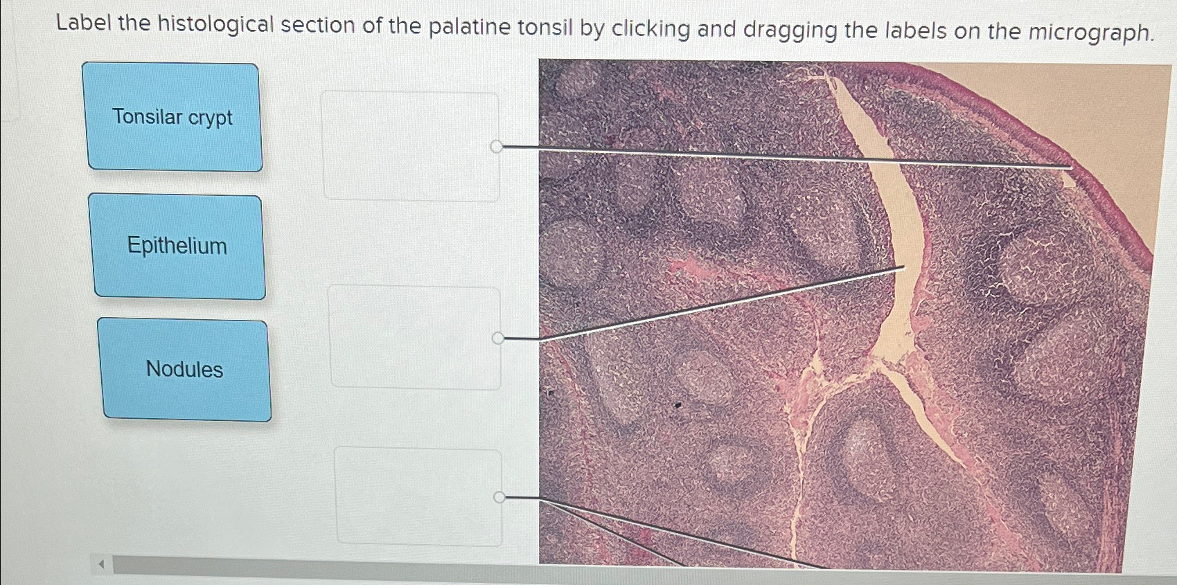 Solved Label The Histological Section Of The Palatine Tonsil