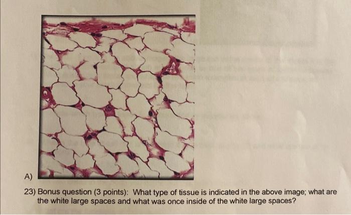 Solved 23) Bonus question ( 3 points): What type of tissue | Chegg.com