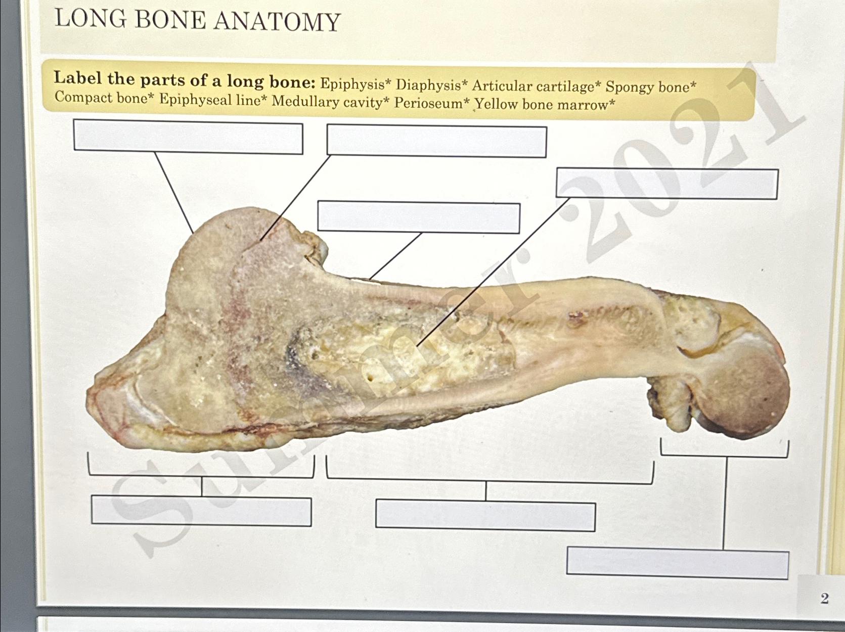 Solved LONG BONE ANATOMYLabel the parts of a long bone: | Chegg.com
