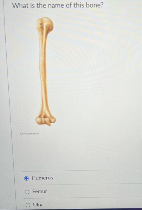 What is the name of this bone? Humerus Femur Ulna | Chegg.com