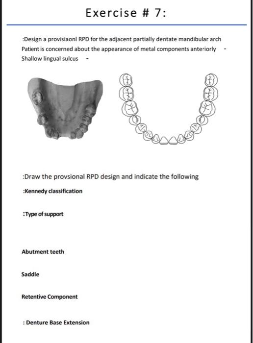 Exercise # 7: Design a provision RPD for the adjacent | Chegg.com