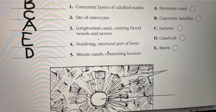Solved 1. Concentric layers of calcified matrix 2. Site of | Chegg.com
