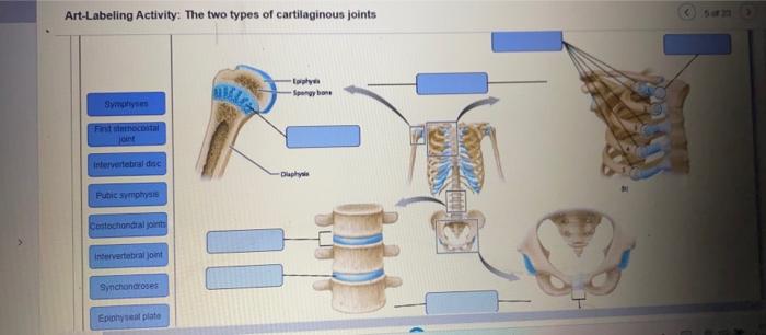 Solved Art-Labeling Activity: The two types of cartilaginous | Chegg.com