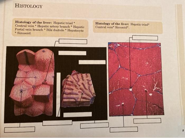 Solved HISTOLOGY Histology of the liver: Hepatic triad* | Chegg.com
