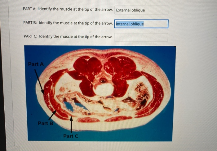 Solved PART A: Identify the muscle at the tip of the arrow. | Chegg.com