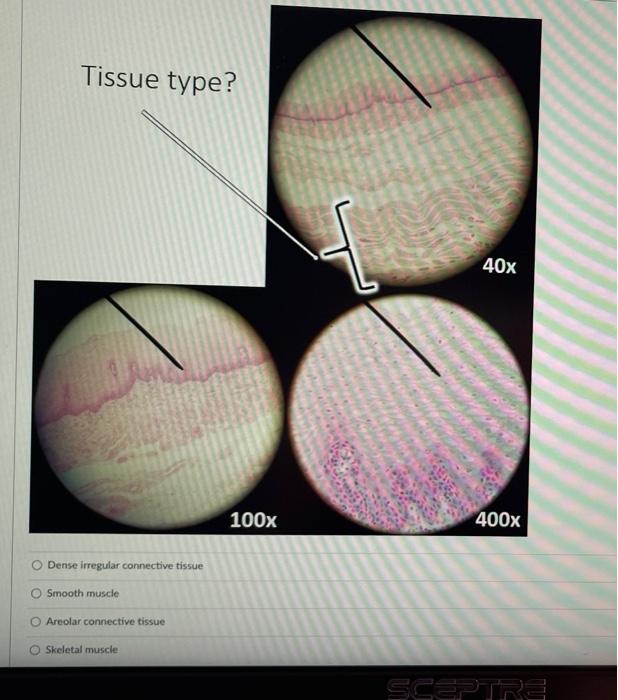 Solved Organ? 100x 400x O Parotid salivary gland Pancreas O | Chegg.com