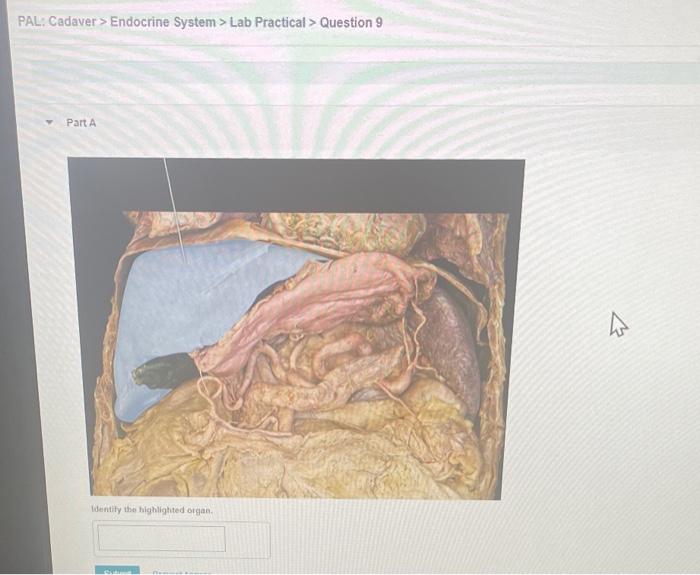 Solved PAL: Cadaver > Endocrine System > Lab Practical > | Chegg.com