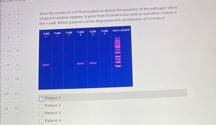 View the results of a PCR procedure to detect the | Chegg.com