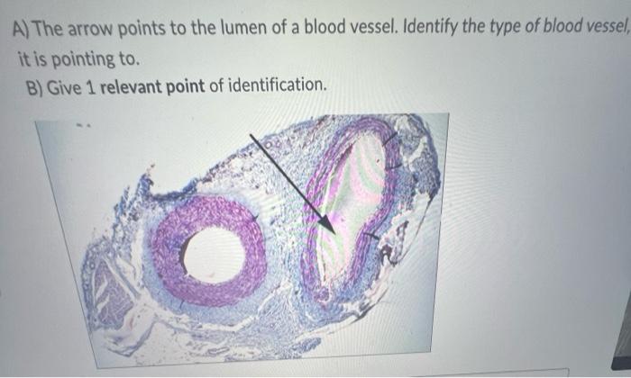 Solved A) The arrow points to the lumen of a blood vessel. | Chegg.com