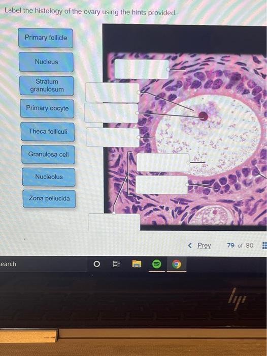 Solved Label the histology of the ovary using the hints | Chegg.com