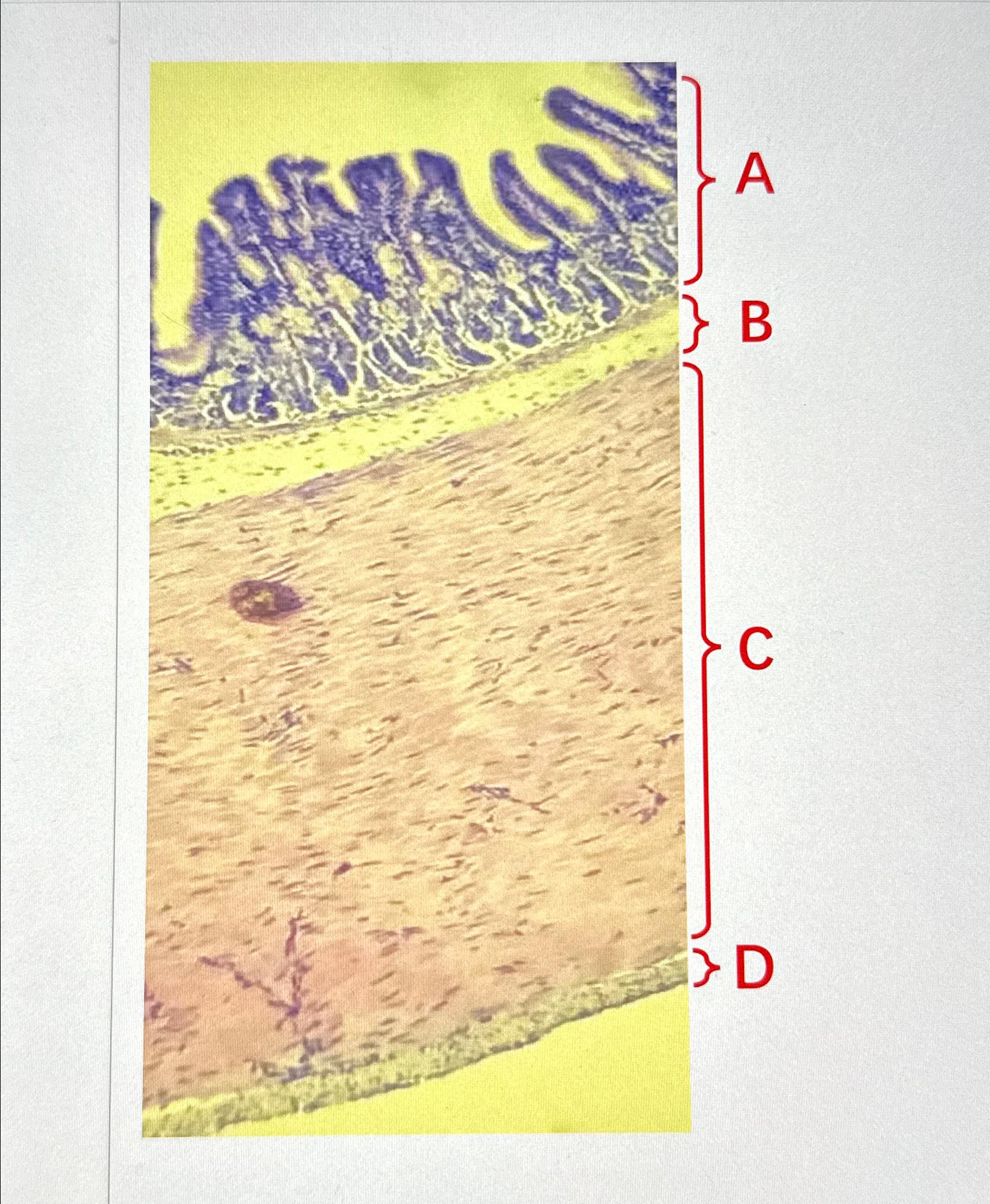 Solved label the following layers of the frog intestine | Chegg.com