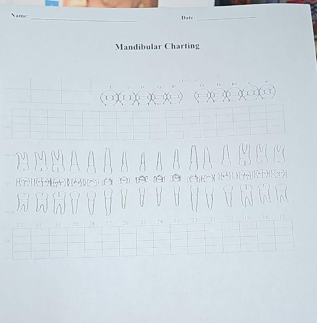 Solved Please help me chart Case A: Using the mandibular | Chegg.com