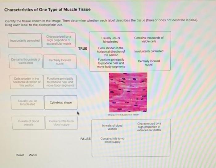 Solved Characteristics of One Type of Muscle Tissue Identify | Chegg.com Solved Characteristics of One Type of Muscle Tissue Identify | Chegg.com