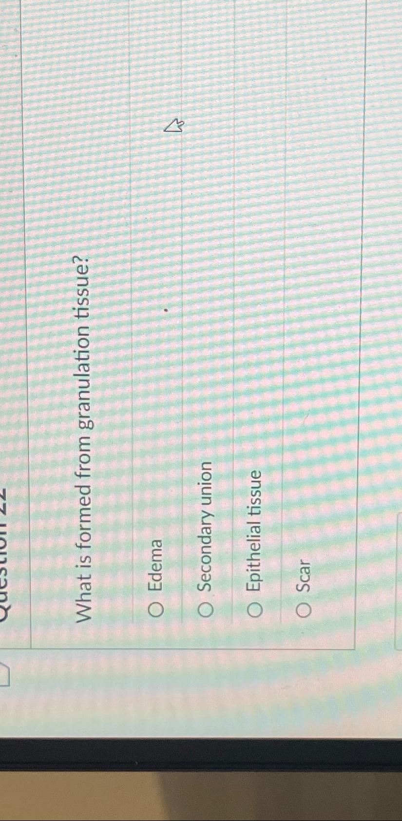 Solved What is formed from granulation tissue?EdemaSecondary | Chegg.com