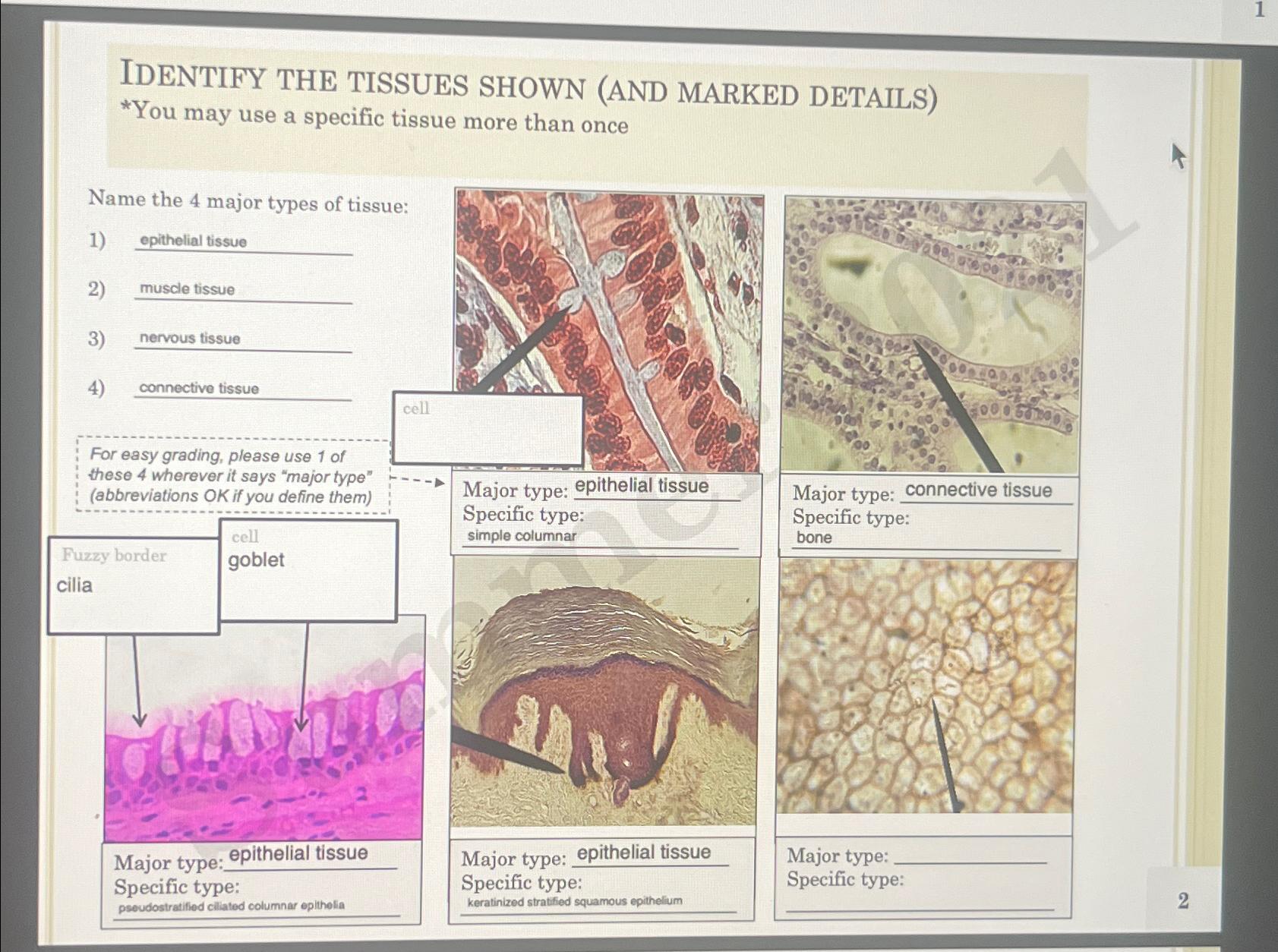 Solved IDENTIFY THE TISSUES SHOWN (AND MARKED DETAILS)*You | Chegg.com